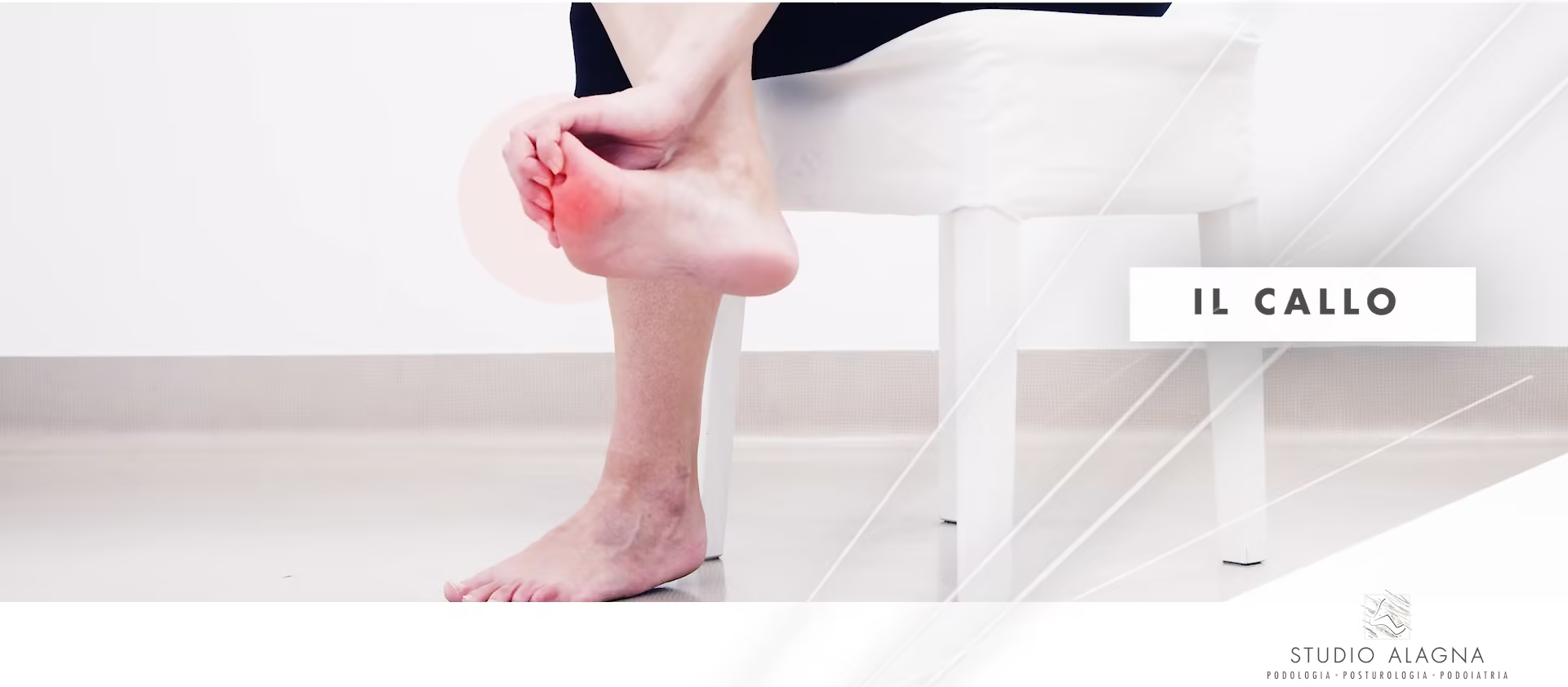 Callosità - Studio Alagna