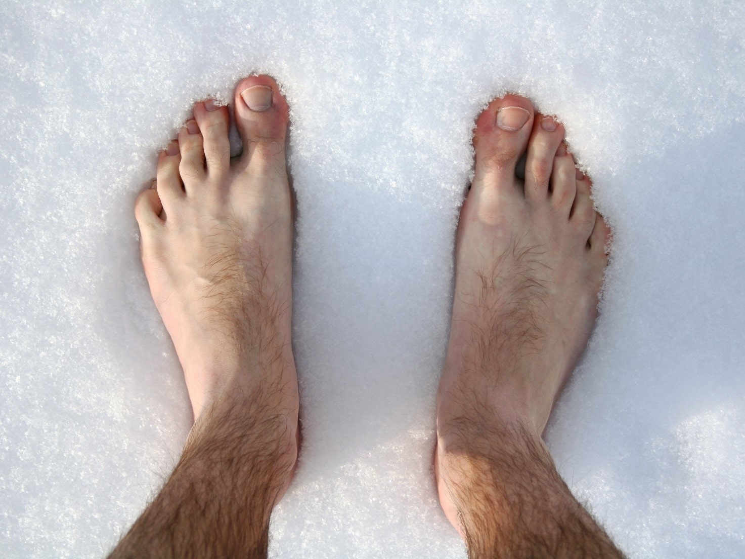 Geloni ai piedi: sintomi, cause e come prevenirli - Studio Alagna